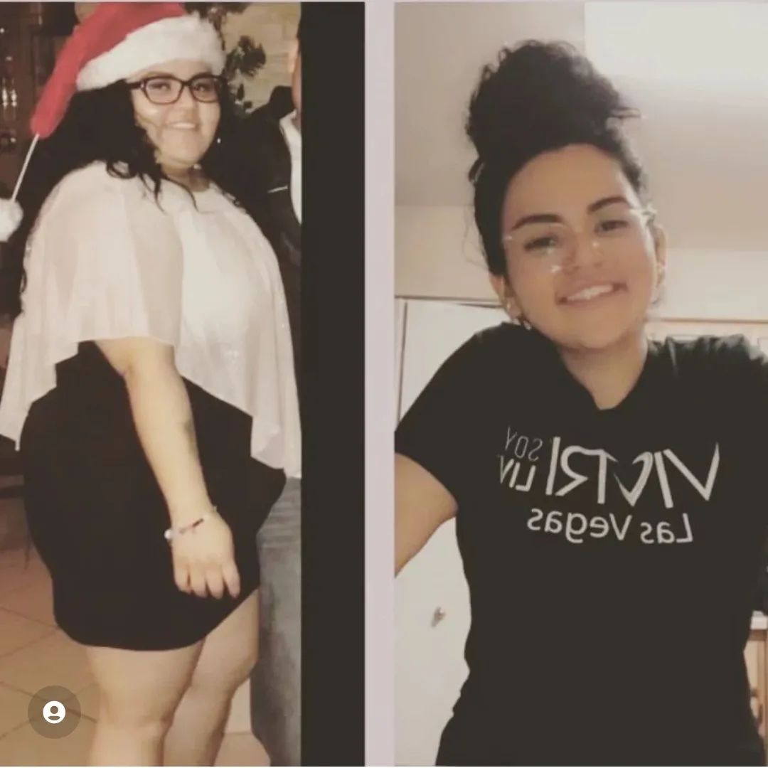 Reto VIVRI 10 días antes y después - Reto Bienestar